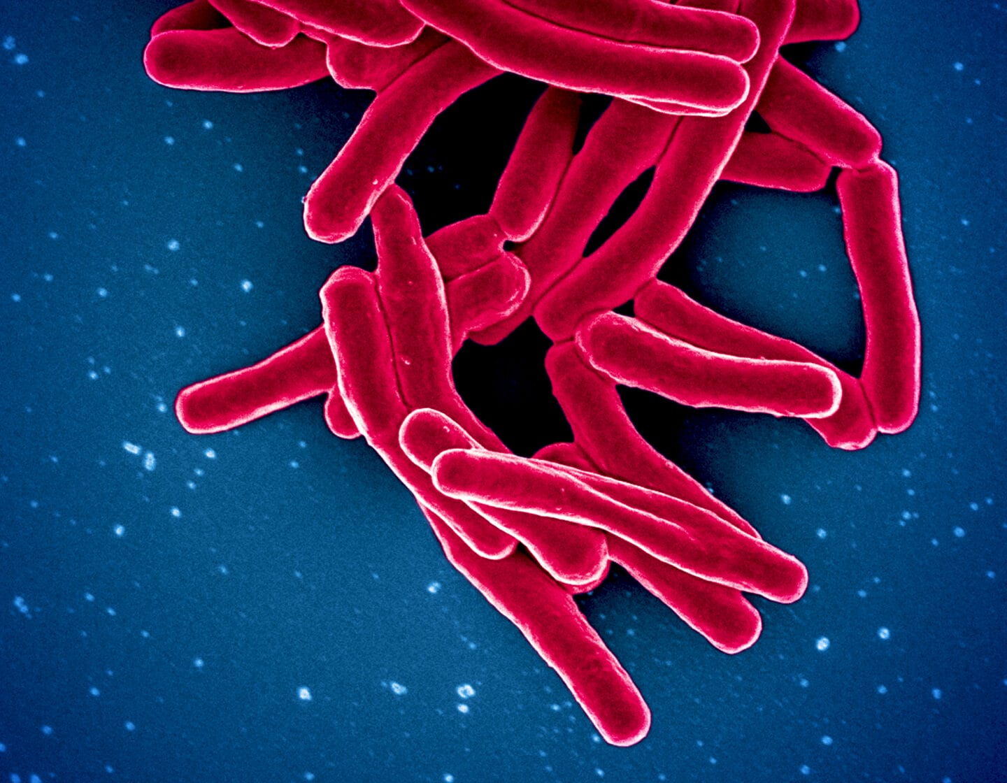 What is tuberculosis?