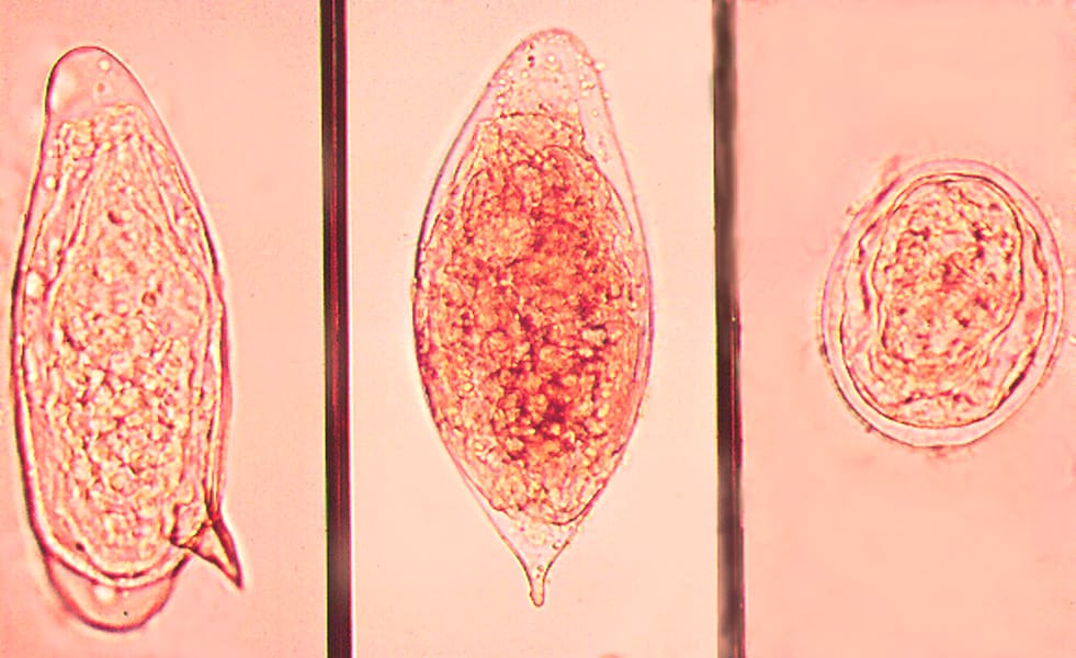 What is schistosomiasis?