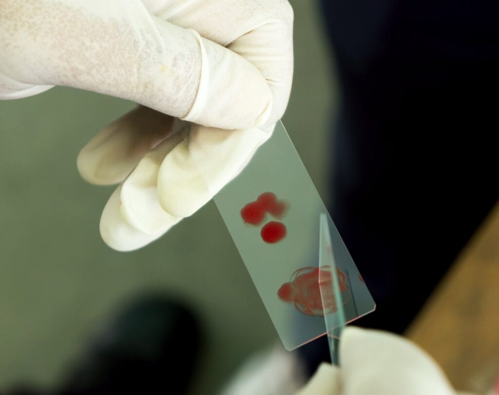 How is malaria treated and prevented?