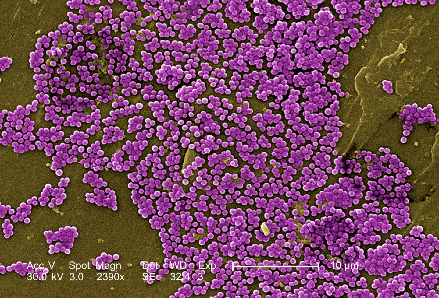 Using genomic surveillance to track MRSA 'superbugs'