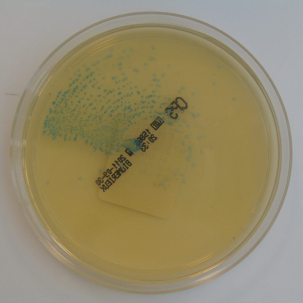 What are Streptococcal infections?