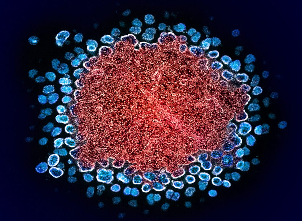 What is HIV?