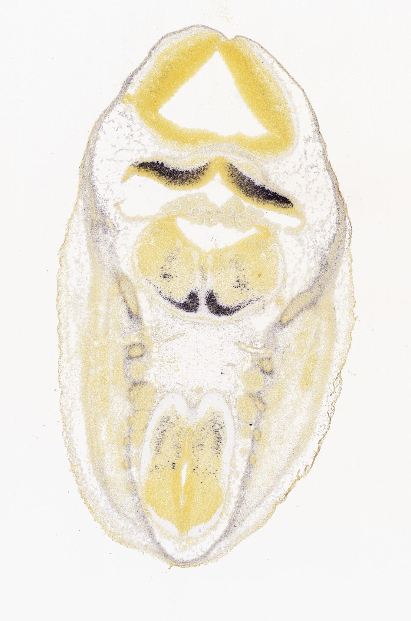 Evolution of the human brain