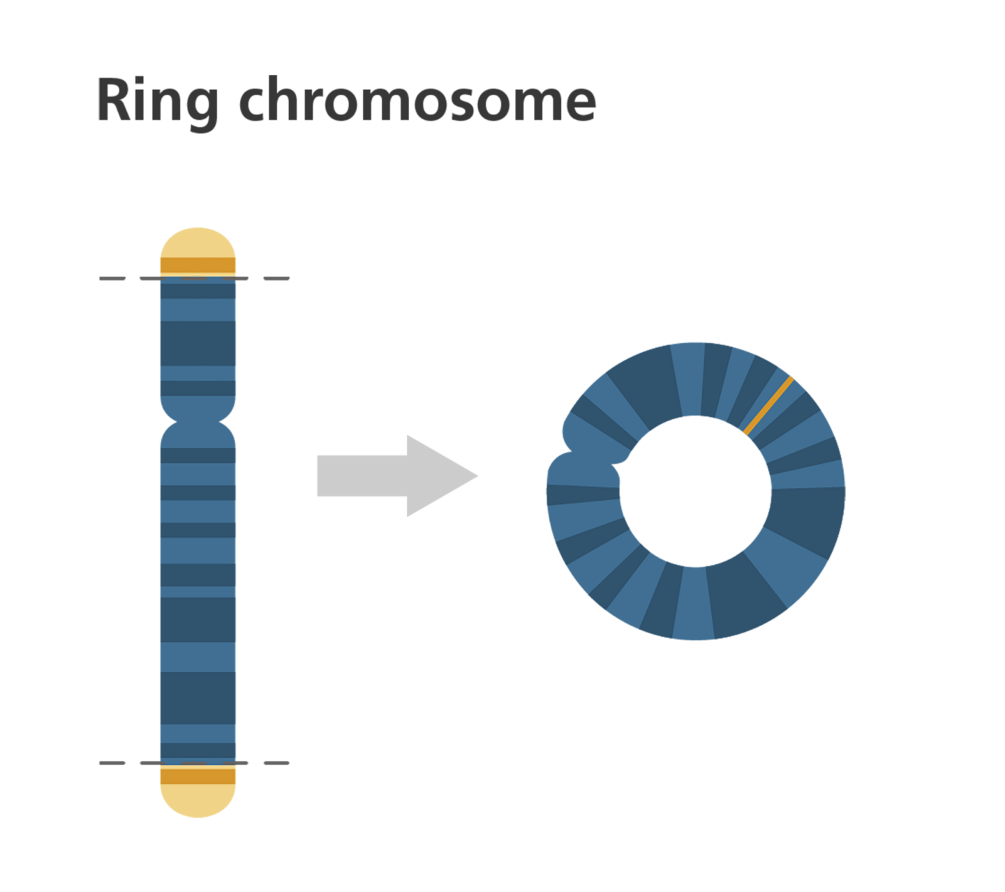 What is a chromosome condition?